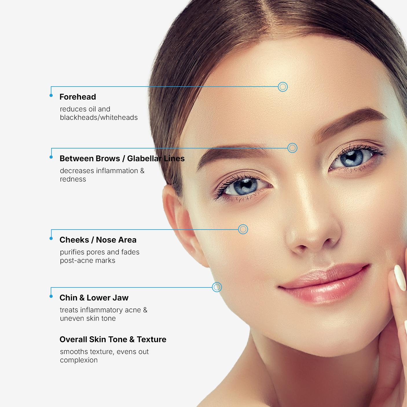 Acnelan Treatment Toronto | NewDermaMed Clinic